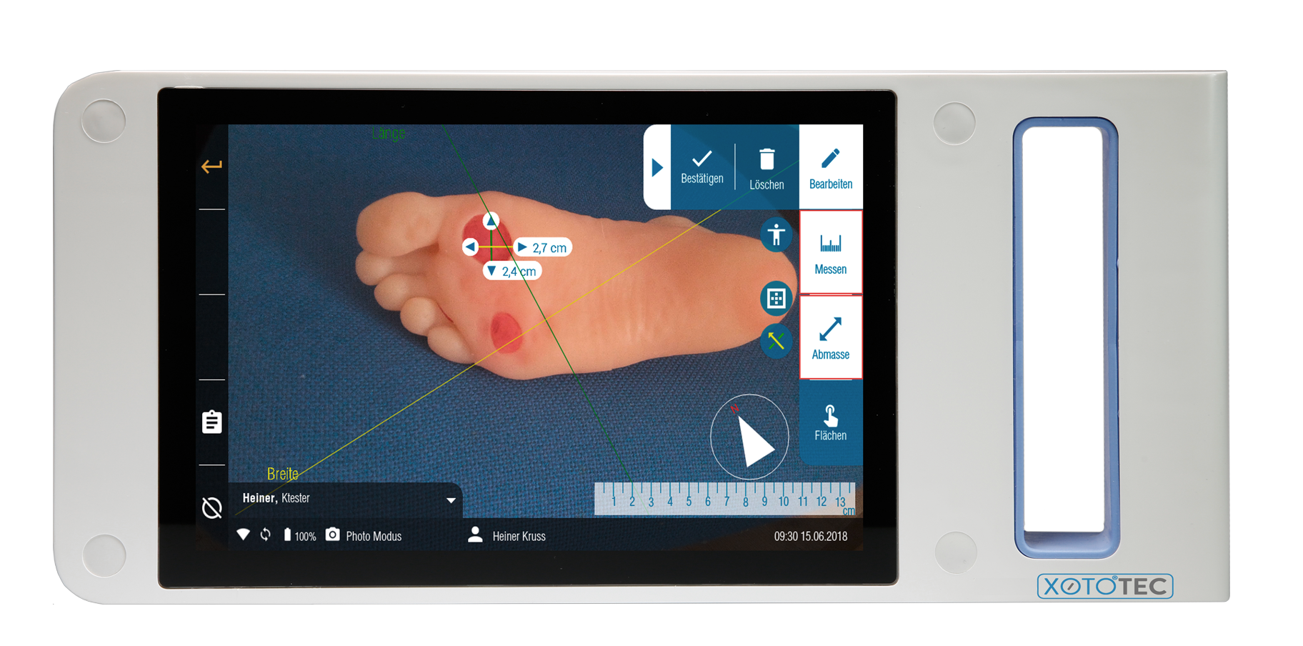 XotoTec- Wunddokumentationssystem | Havel Healthcare